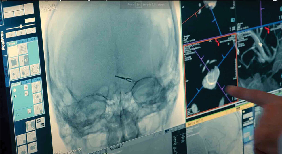 Department of Neuroradiology - Rockefeller Neuroscience Institute